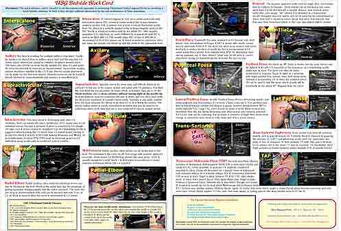 Ultrasound Guided Regional Blocks: USG Bedside Block Card. Roca Redonda ...